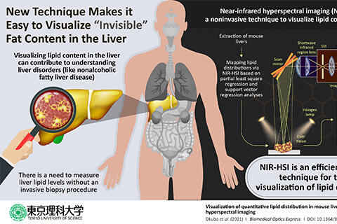Quantitative Detection of Fatty Liver Disease by Assessing Fat ...